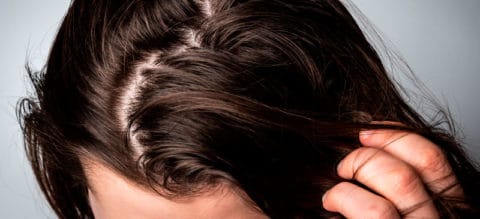 Greasy Hair: How to Get Rid of It Naturally - Dr. Axe