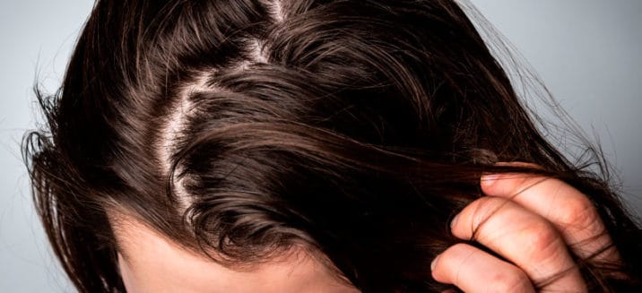 Greasy Hair: How to Get Rid of It Naturally - Dr. Axe